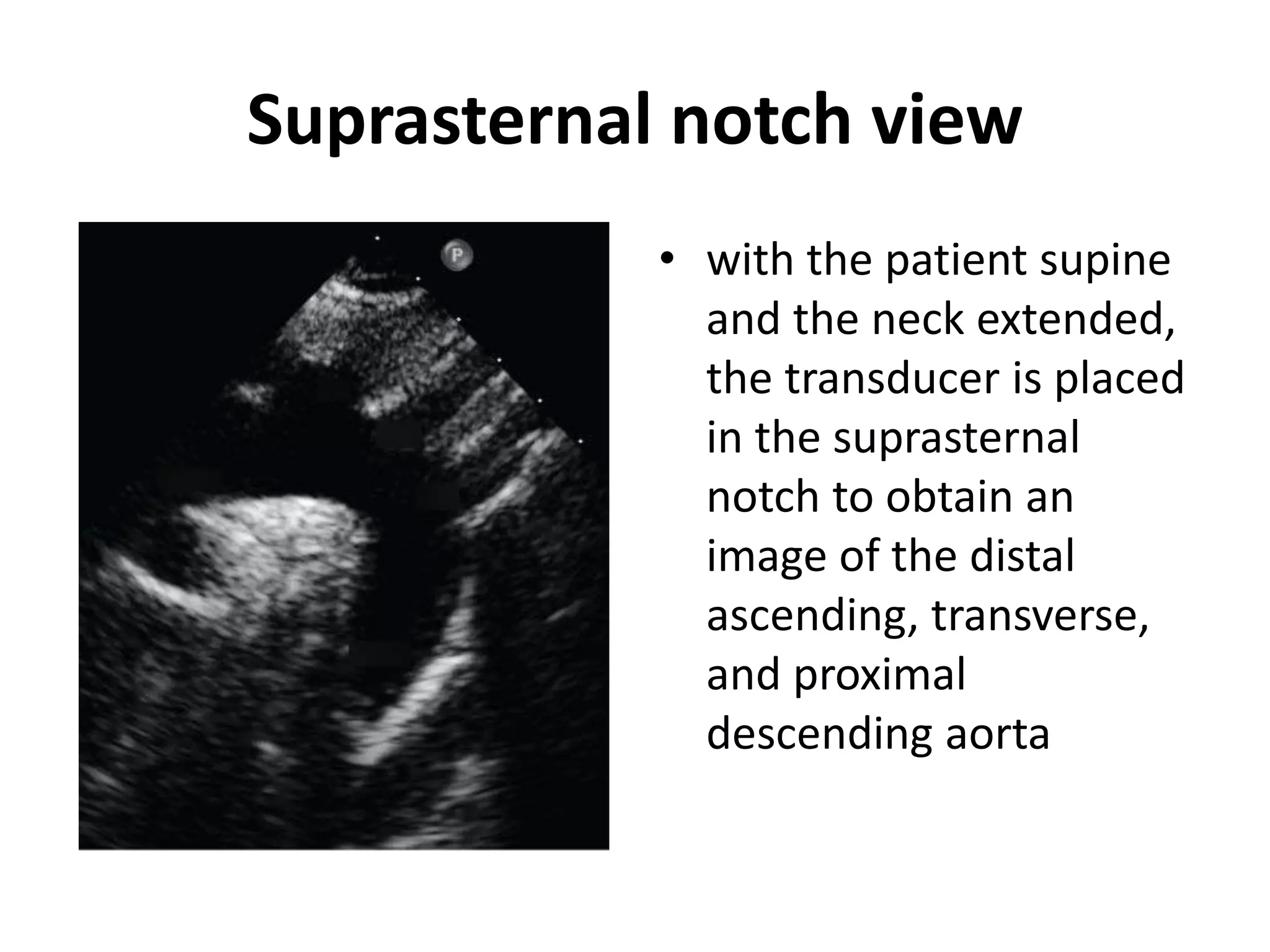 2d Transthoracic Echocardiographic views | PPT