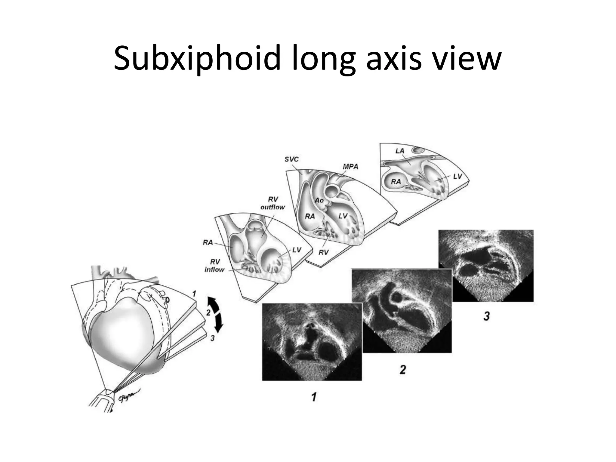 2d Transthoracic Echocardiographic views | PPT