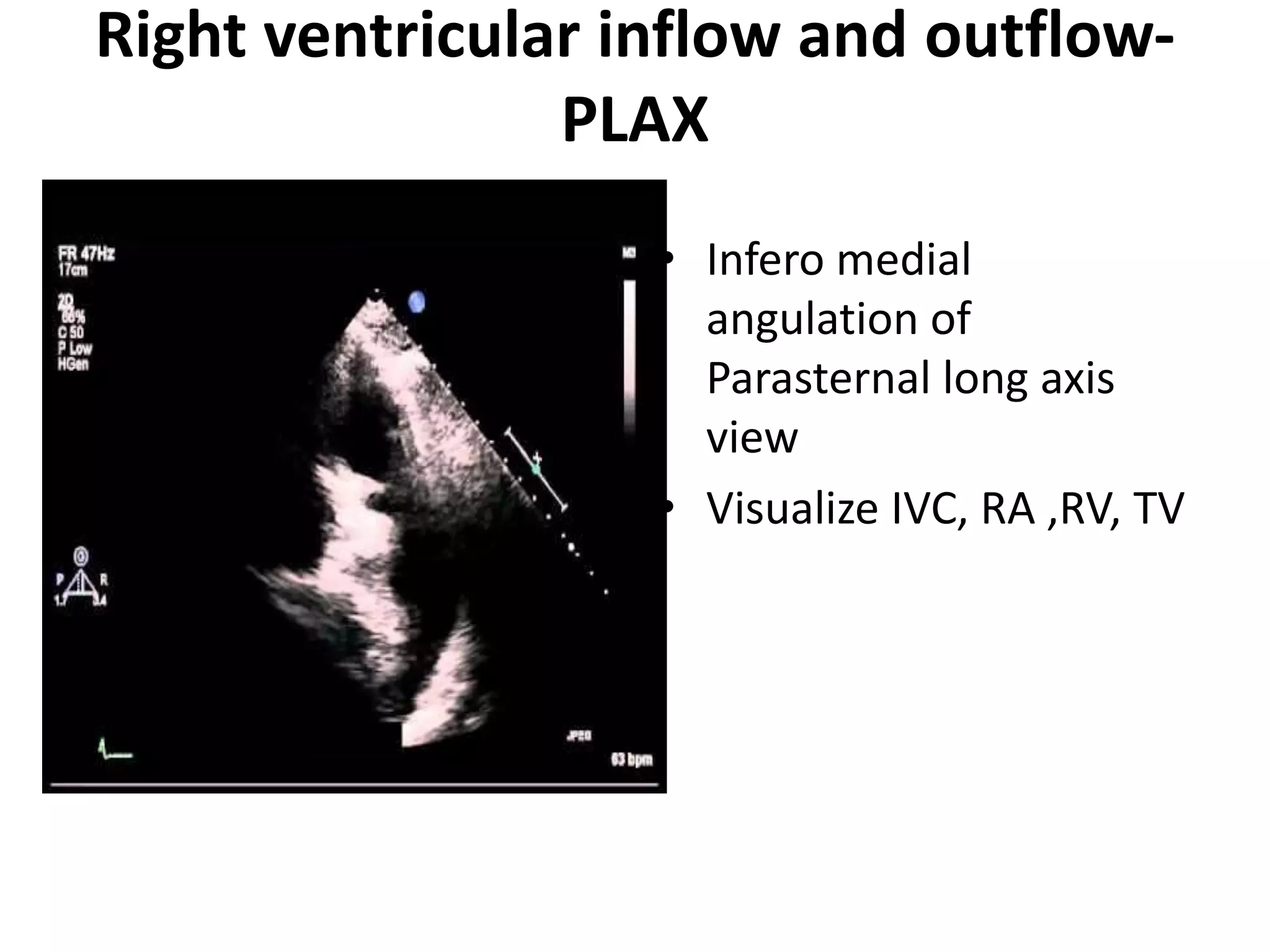 2d Transthoracic Echocardiographic views | PPT