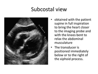 2d Transthoracic Echocardiographic views | PPT