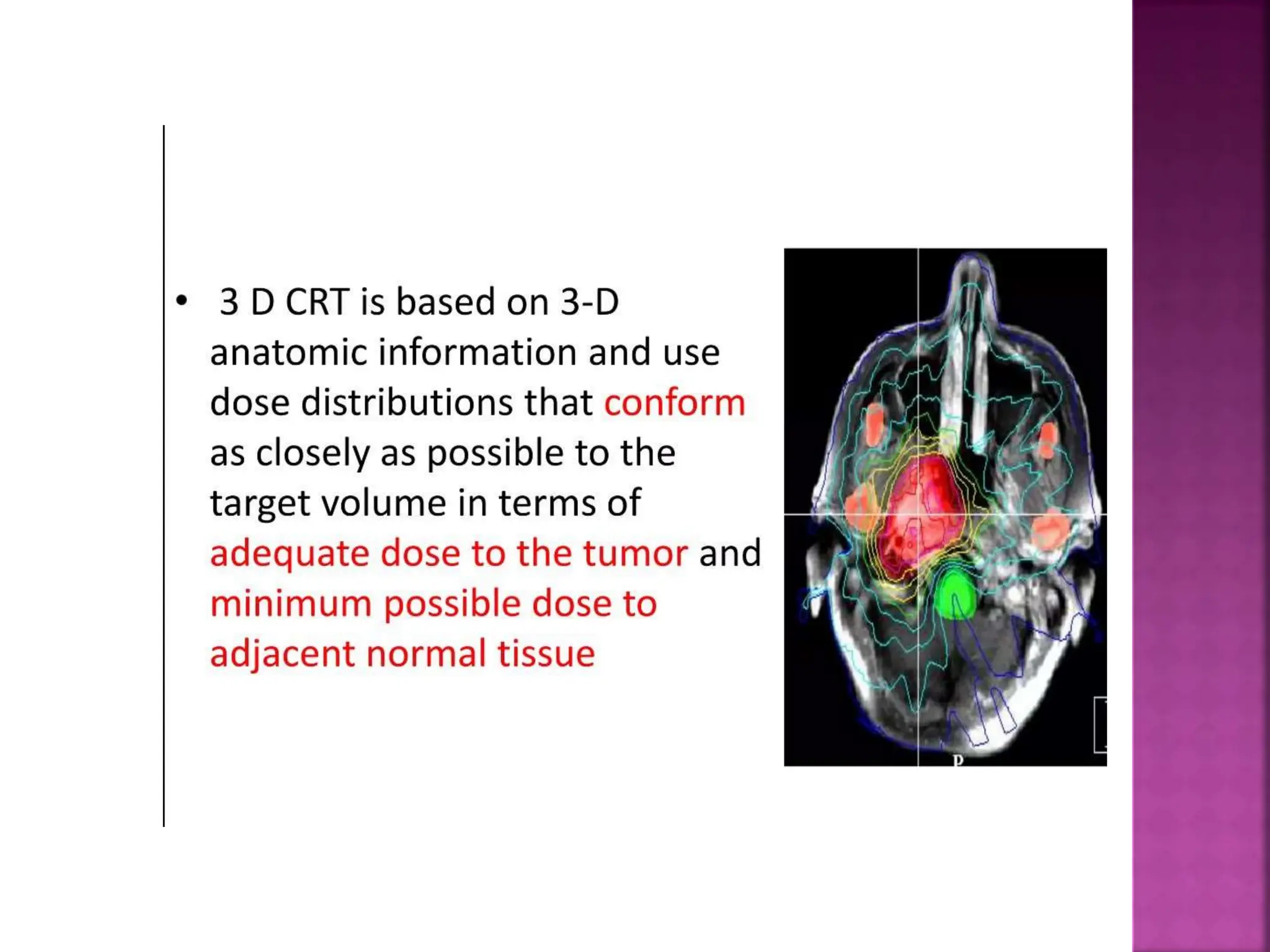 2D VS 3D-CRT.pptx