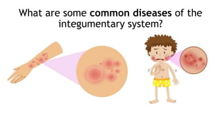 Integumentary system | PPT