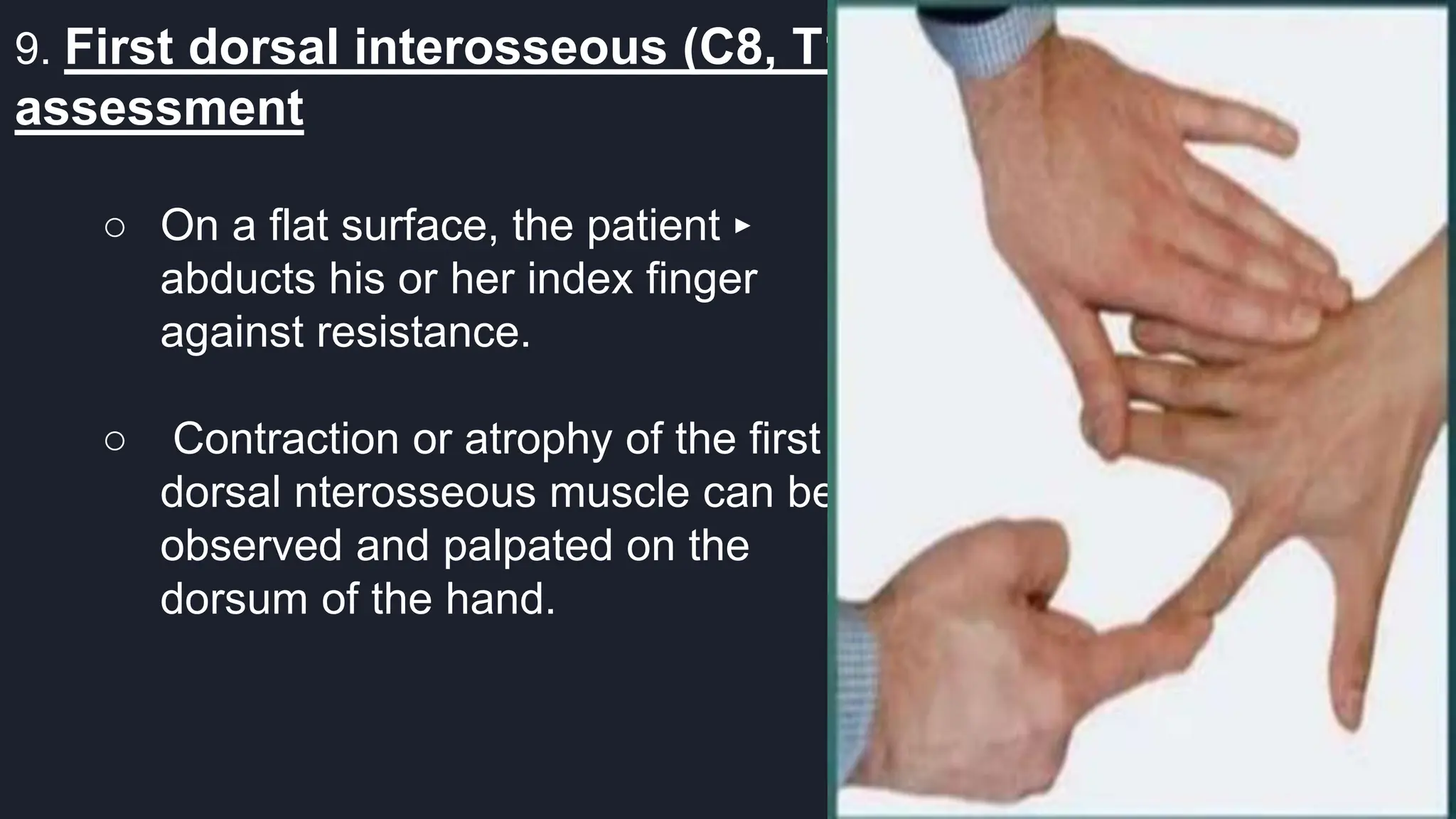 Ulnar_nerve_palsy_and_Tendon_transfer.pptx