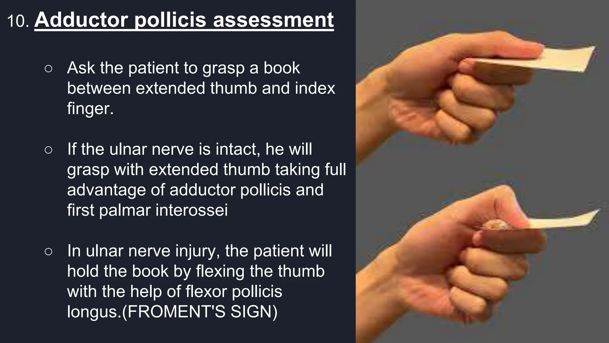 Ulnar_nerve_palsy_and_Tendon_transfer.pptx | Death, Injury, or Military ...