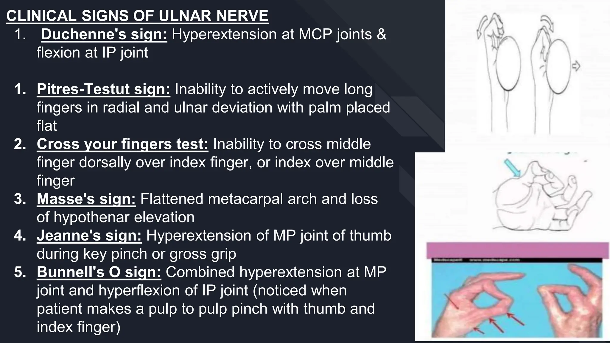 Ulnar_nerve_palsy_and_Tendon_transfer.pptx