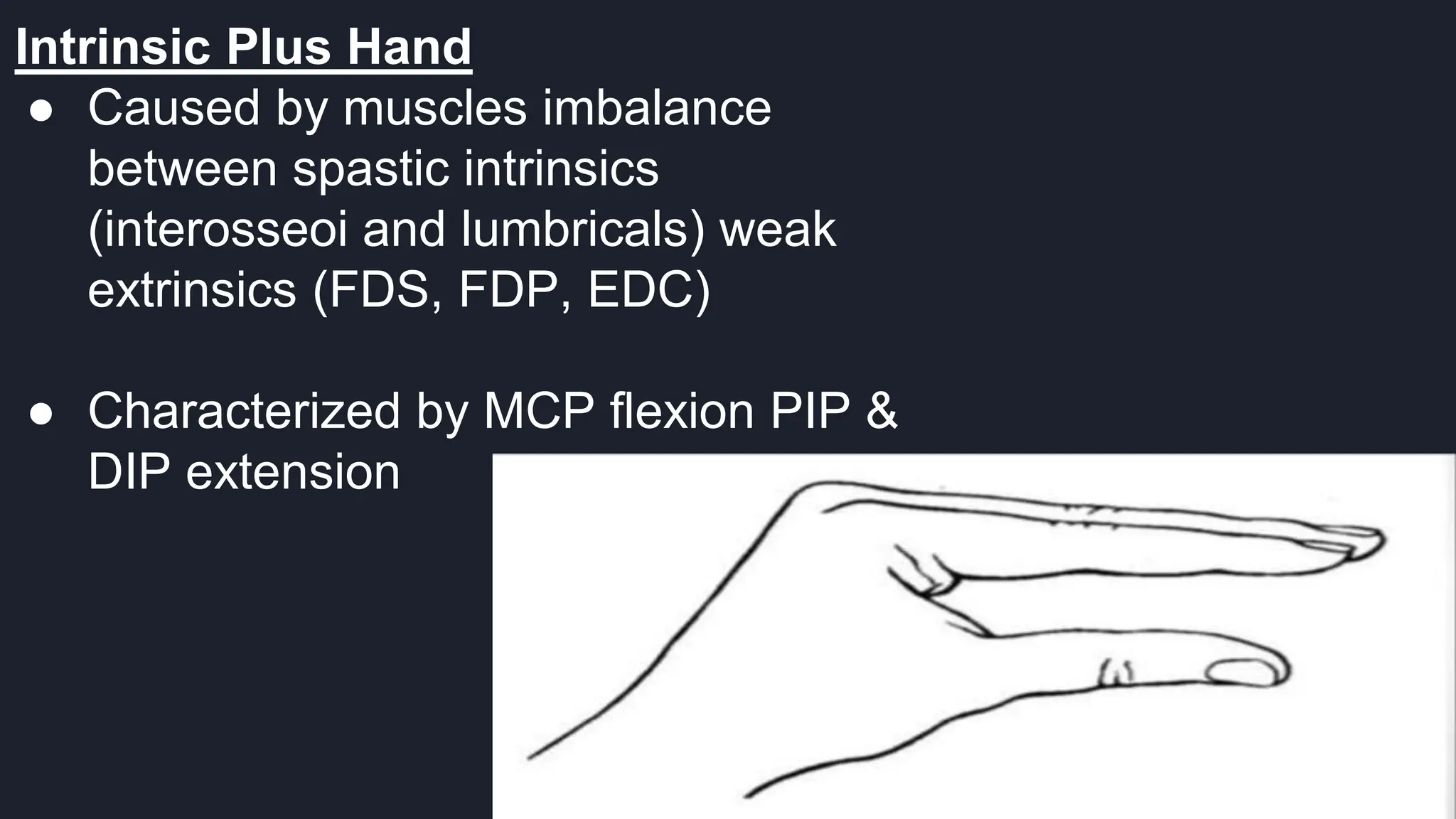 Ulnar_nerve_palsy_and_Tendon_transfer.pptx