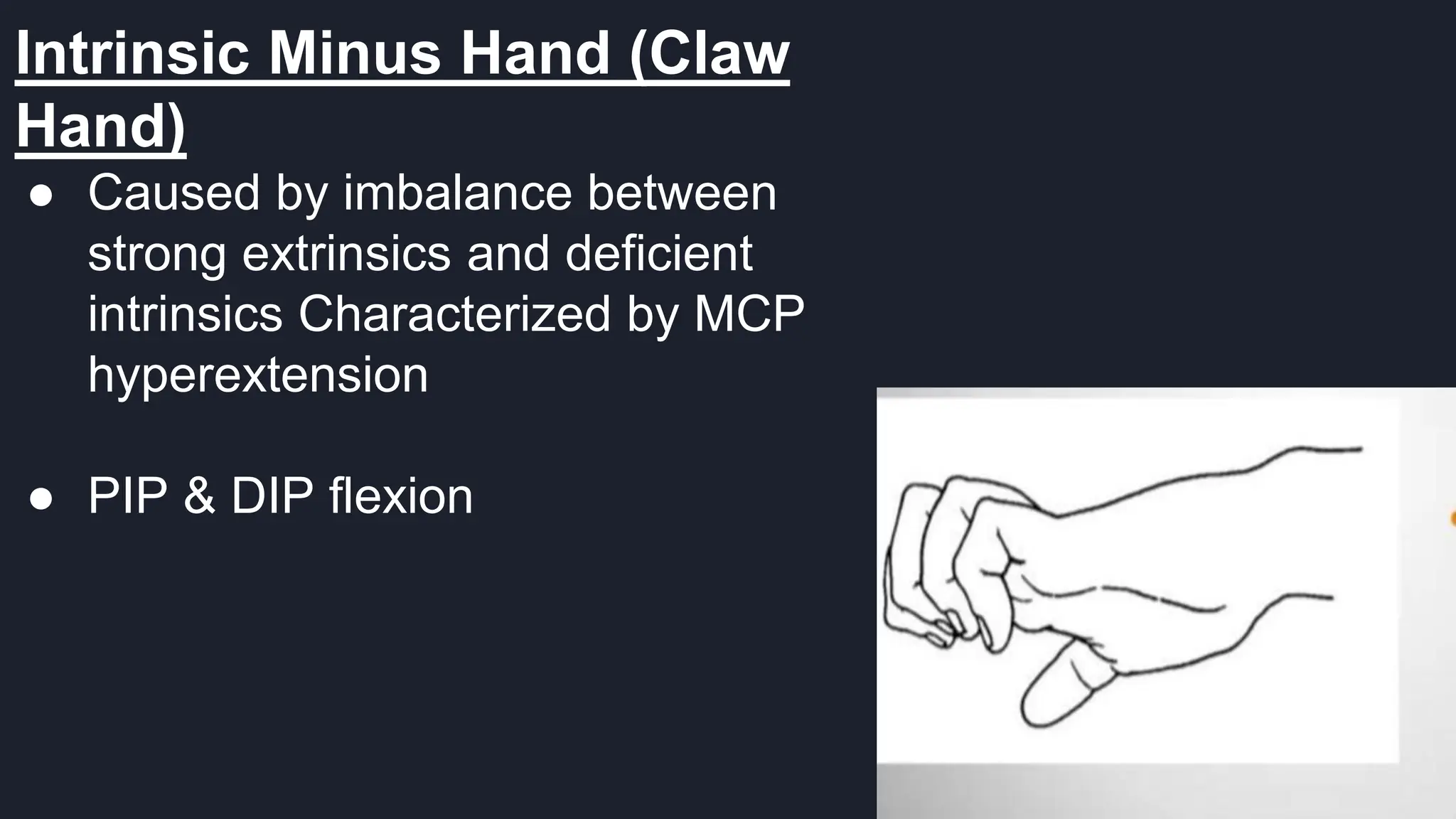 Ulnar_nerve_palsy_and_Tendon_transfer.pptx