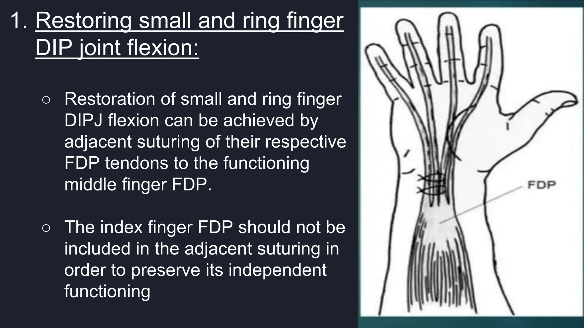 Ulnar_nerve_palsy_and_Tendon_transfer.pptx