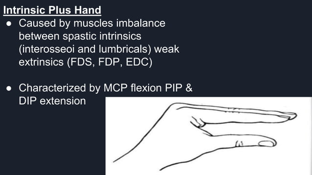 Ulnar_nerve_palsy_and_Tendon_transfer.pptx | Death, Injury, or Military ...