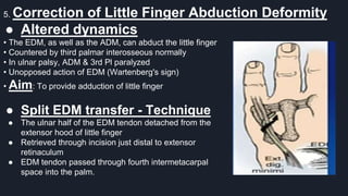 Ulnar_nerve_palsy_and_Tendon_transfer.pptx