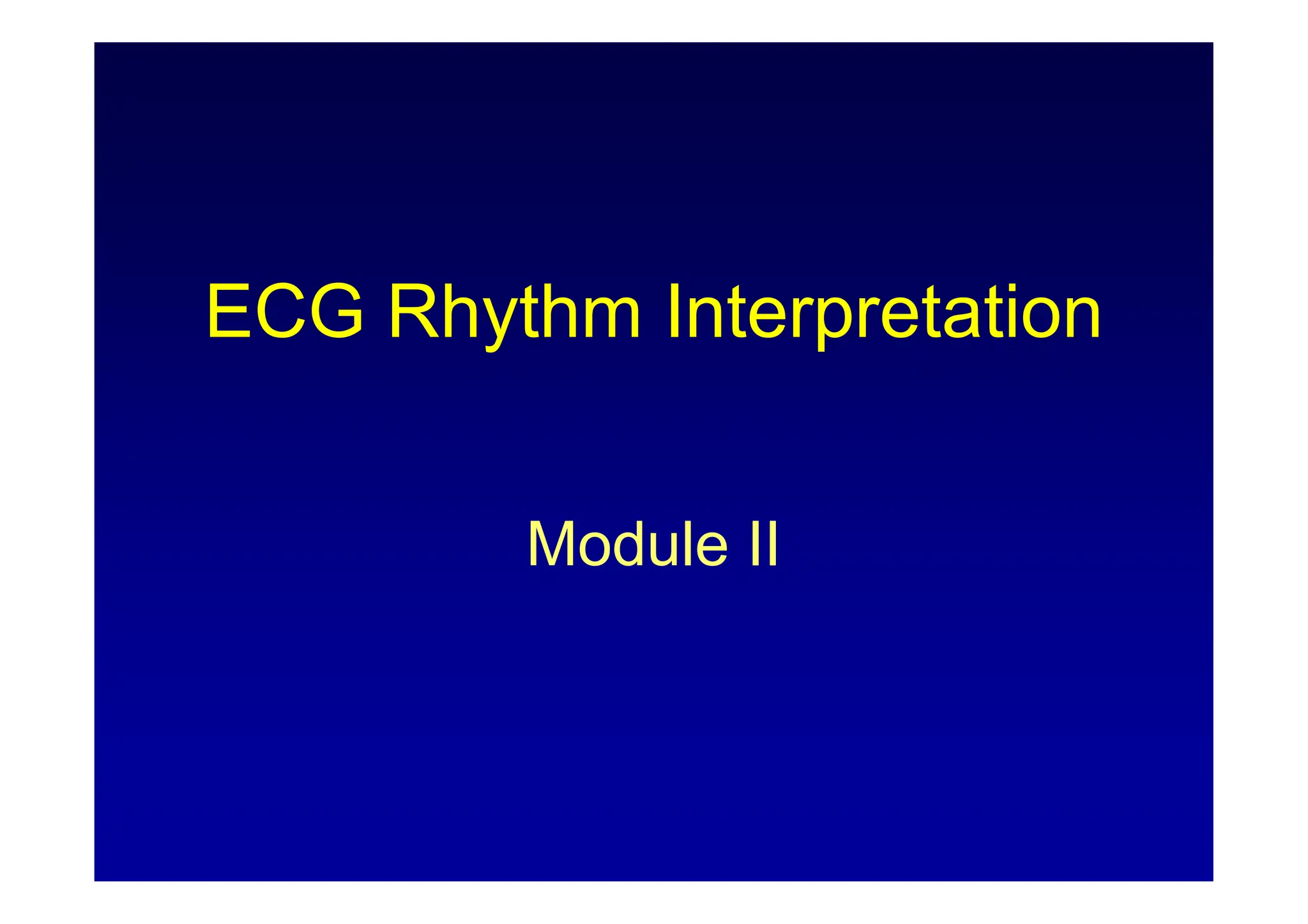 ECG Rhythm Interpretation (ECG Rhythm Analysis) | PDF