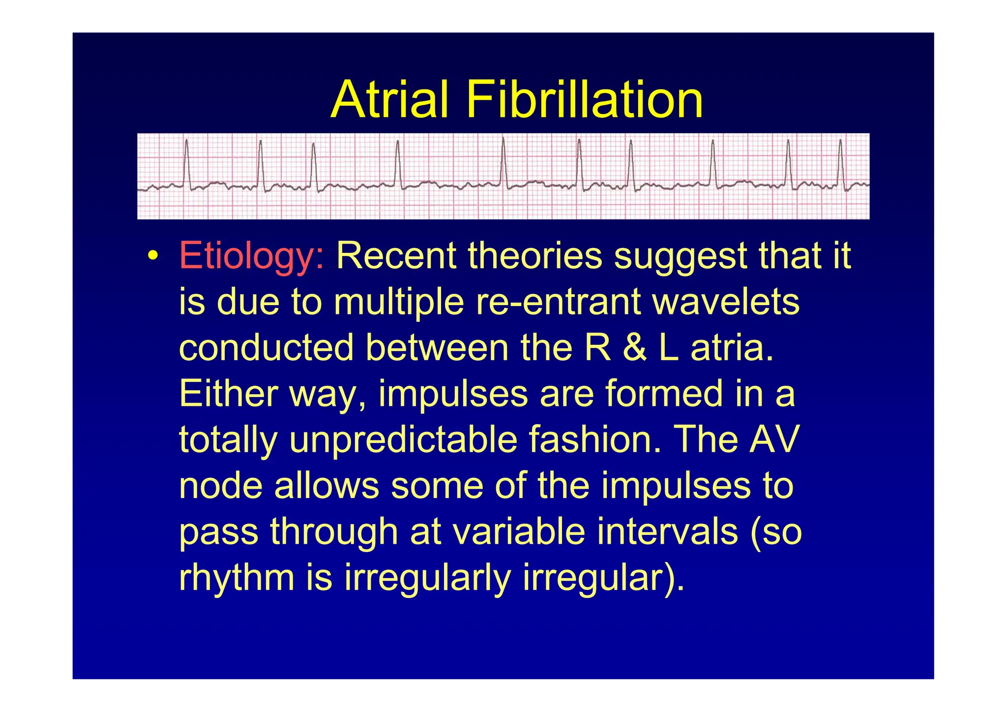 ECG Rhythm Interpretation (ECG Rhythm Analysis) | PDF