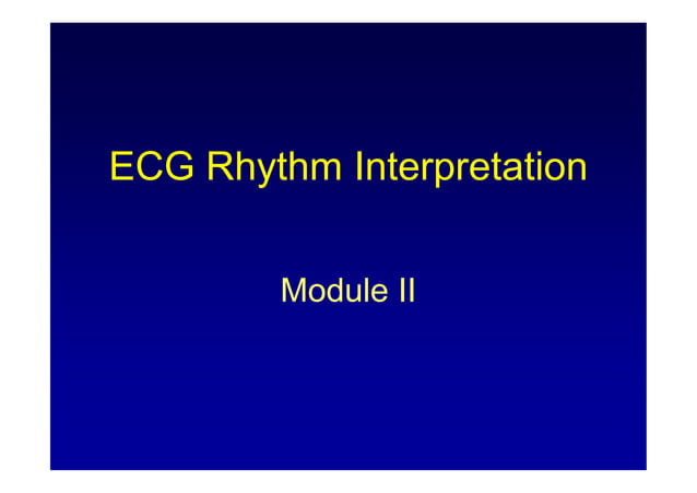 ECG Rhythm Interpretation (ECG Rhythm Analysis) | PDF