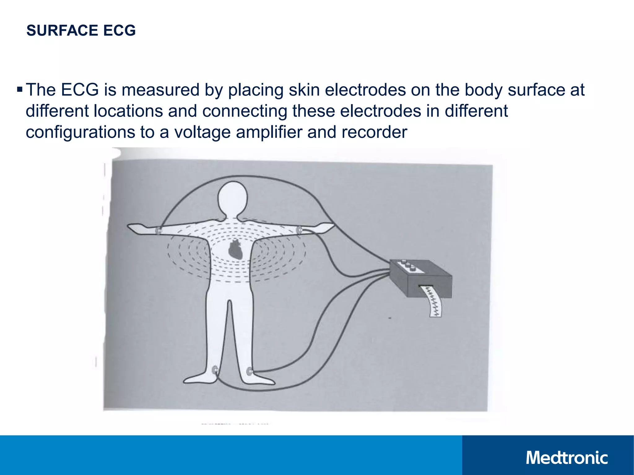 ECG & Intro to Cardiac Arrhythmias.pptx