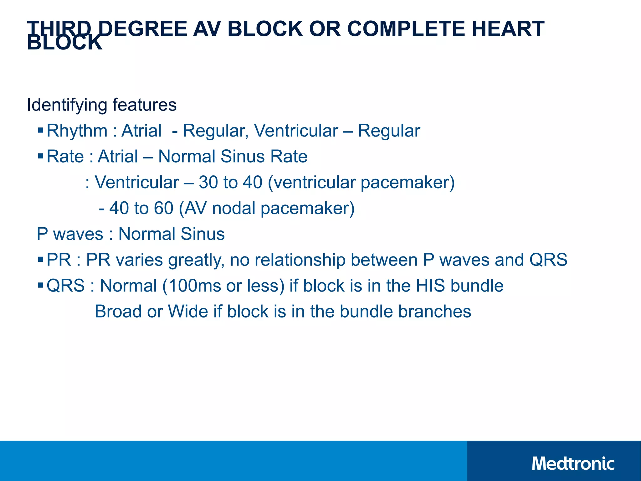 ECG & Intro to Cardiac Arrhythmias.pptx