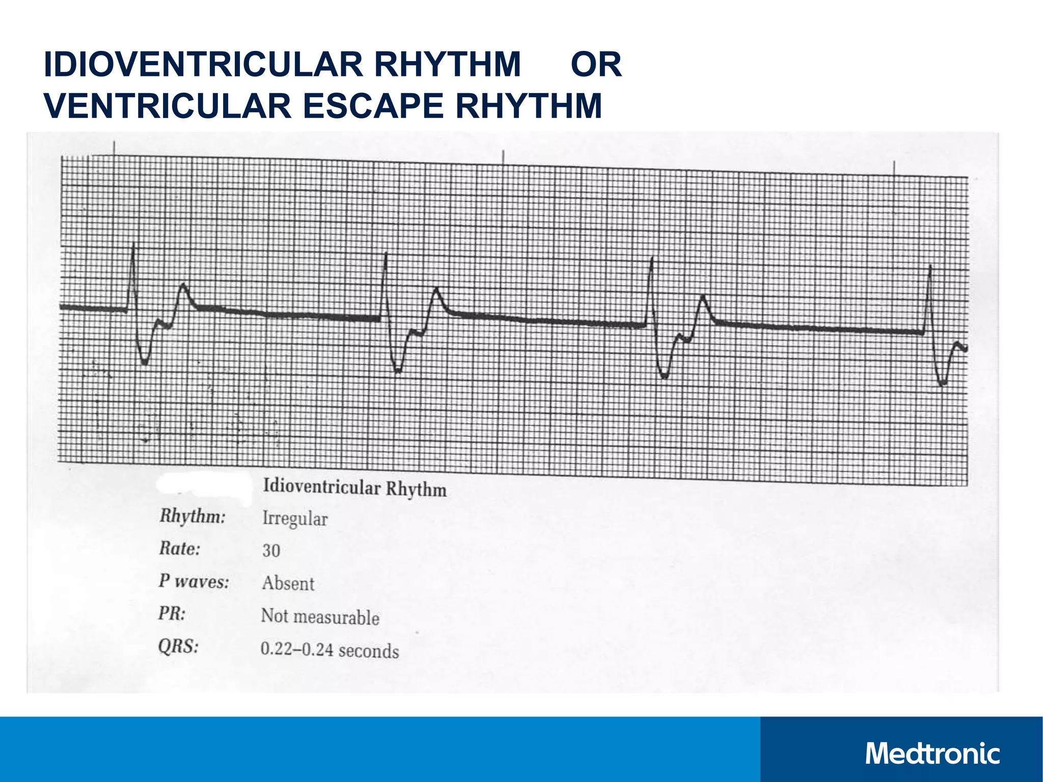 ECG & Intro to Cardiac Arrhythmias.pptx