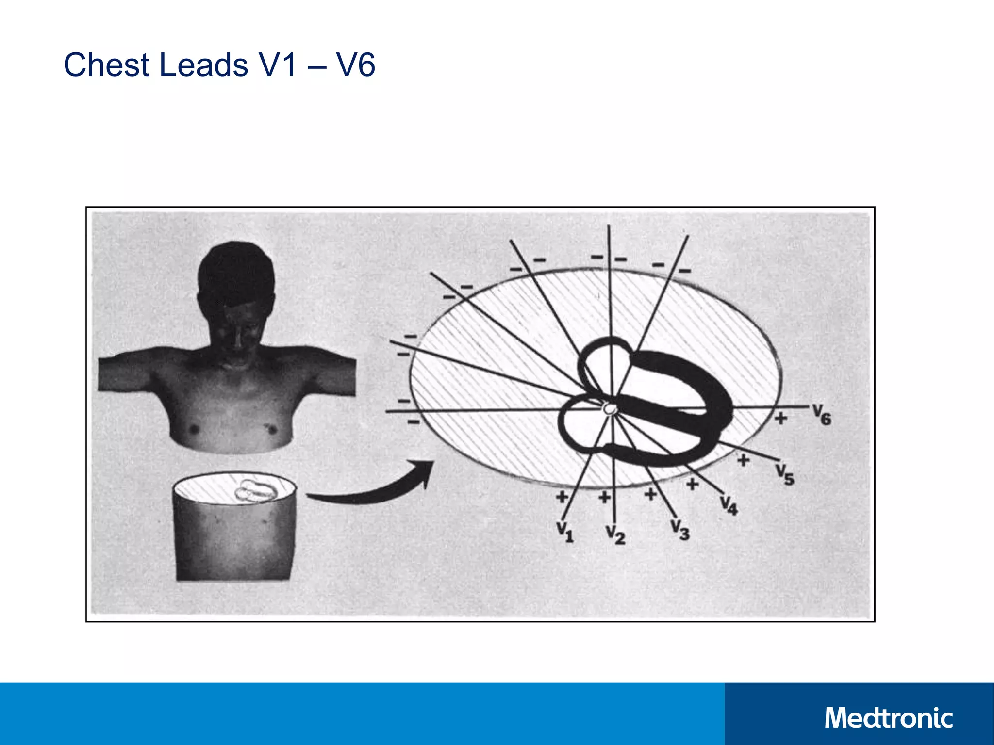 Ecg And Intro To Cardiac Arrhythmias Pptx