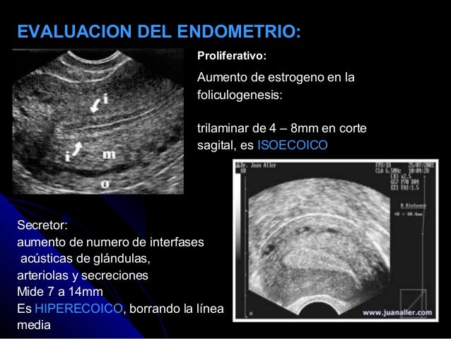 (2) ecografia ginecologica presentacion 29.06.16