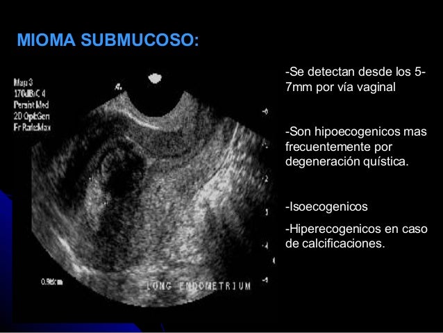 (2) ecografia ginecologica presentacion 29.06.16