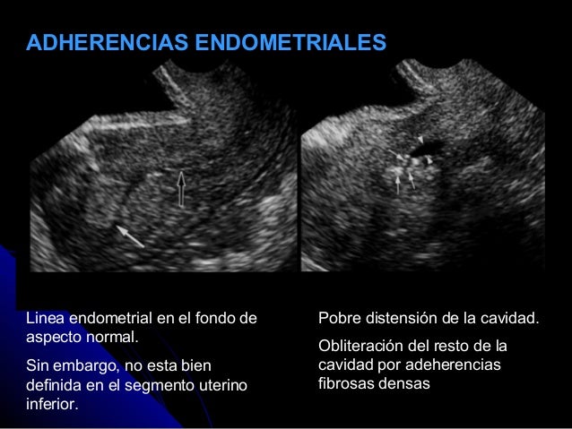 (2) ecografia ginecologica presentacion 29.06.16