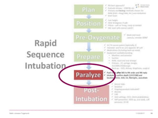 How to relax before and after an RSI intubation | PPTX