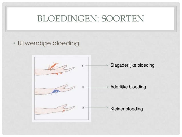 Ehbo levensbedreigende en niet levensbedreigende situaties
