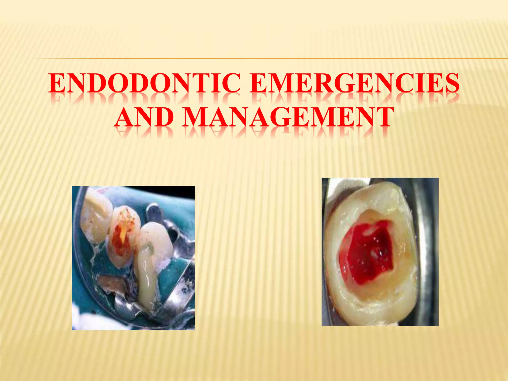 Dr. Ragi Endodontic Emergencies and Management | PPTX | Dental Health | Diseases and Conditions