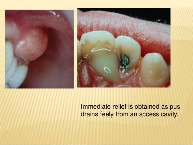 Dr. Ragi Endodontic Emergencies and Management