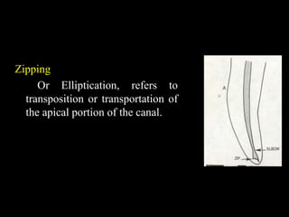 2 endodontic mishaps.pptx