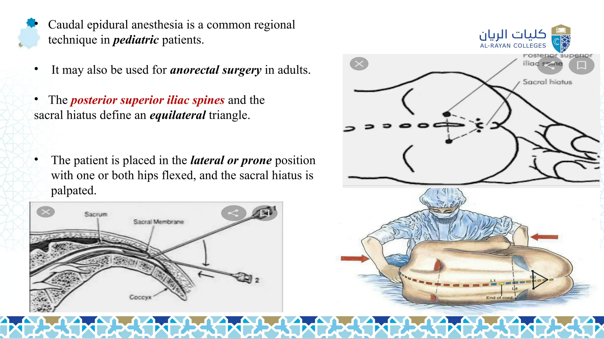2 EPIDURAL and CAUDAL regional anesthesia | PPTX