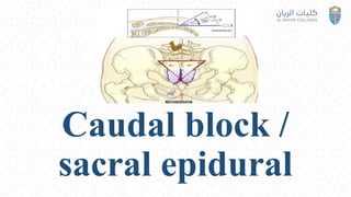 2 EPIDURAL and CAUDAL regional anesthesia | PPTX