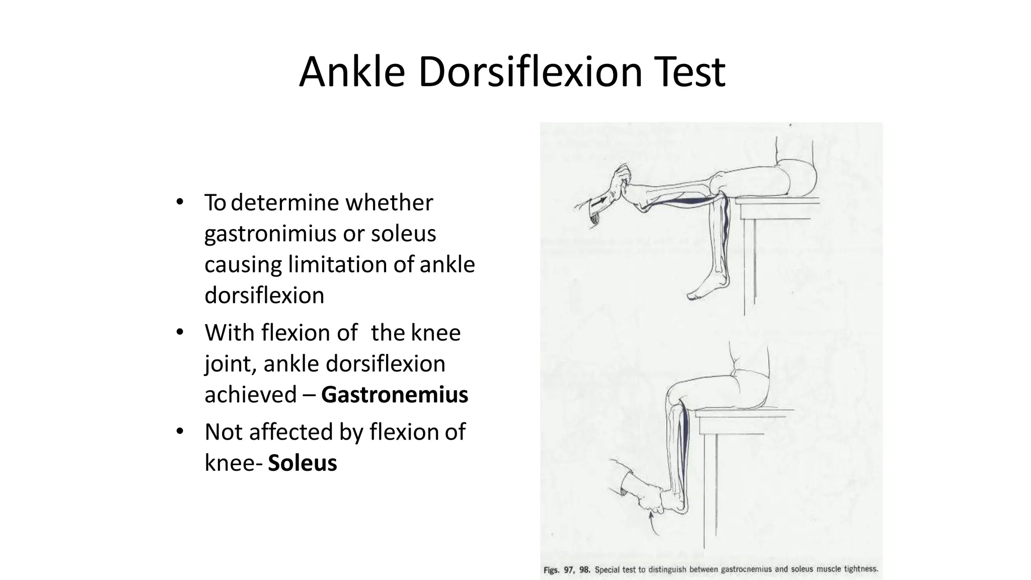 2 Evaluating for Syndesmotic injury.pptx