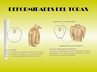2 examen de torax | PPT