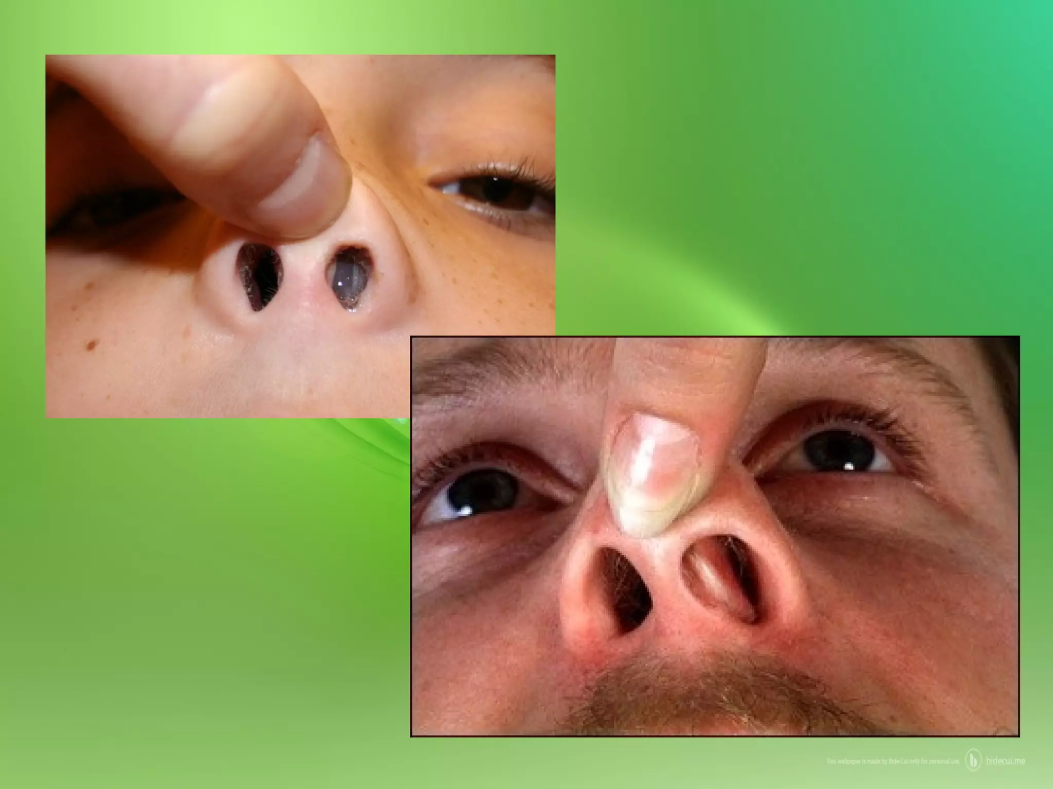 2 examen fisico de region nasal y senos paranasales | PPT | Ear, Nose ...