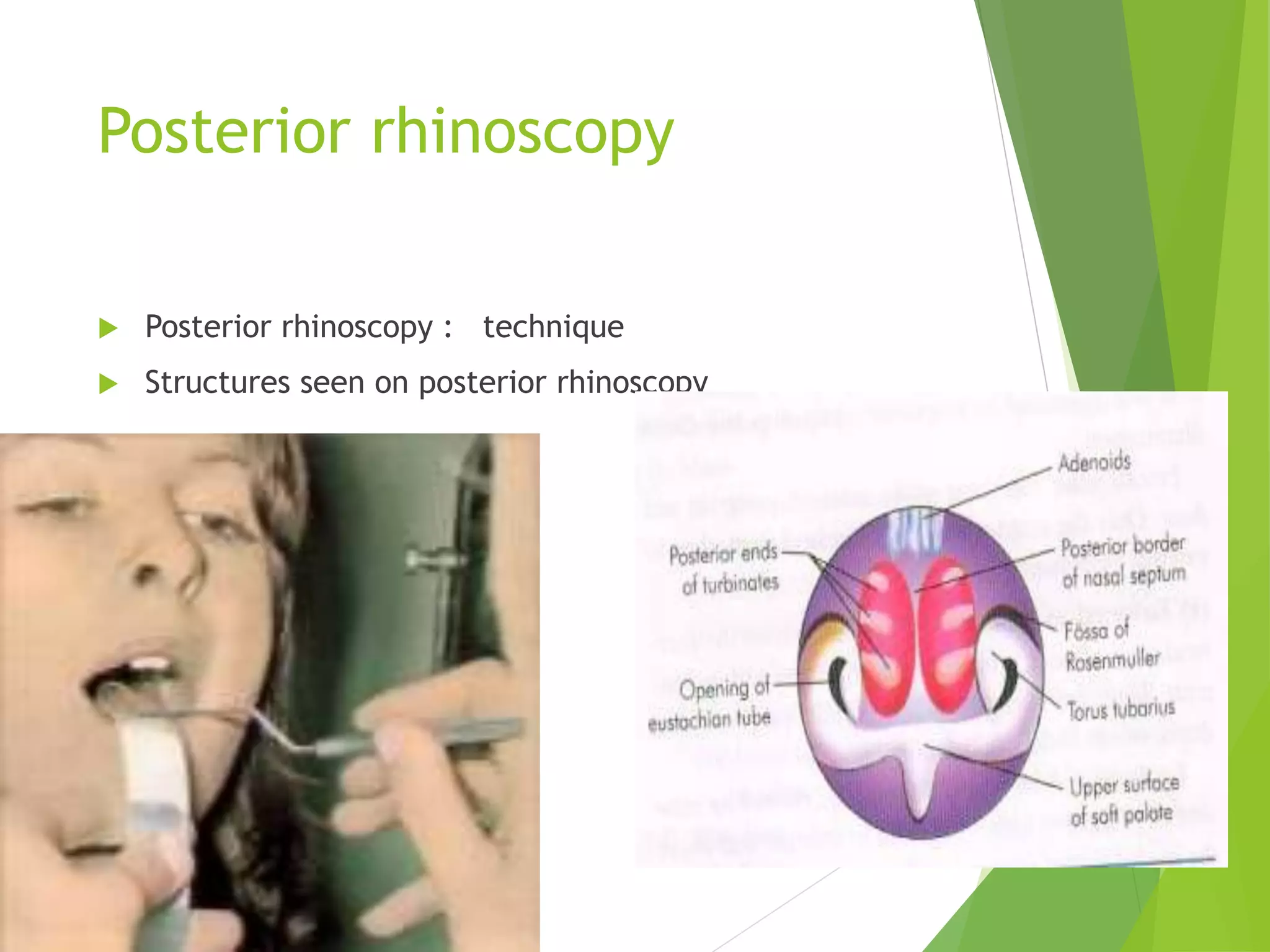 2 examination of nose and pns | PPTX
