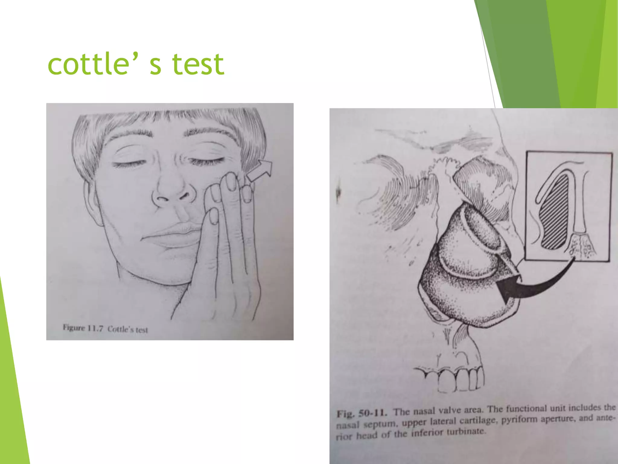 2 examination of nose and pns | PPTX