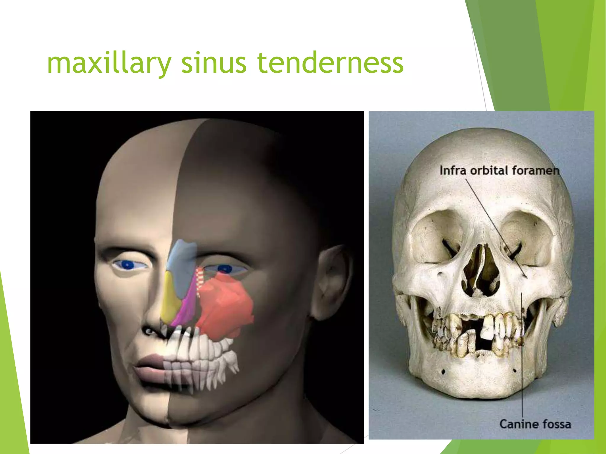 2 examination of nose and pns | PPTX