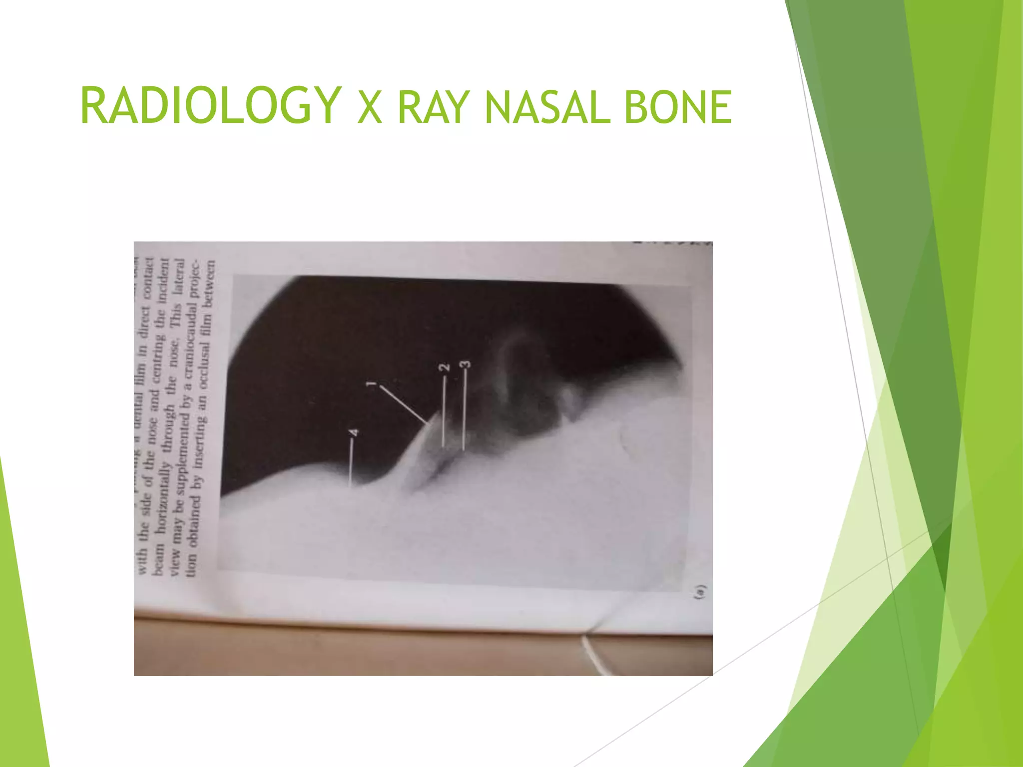 2 examination of nose and pns | PPTX