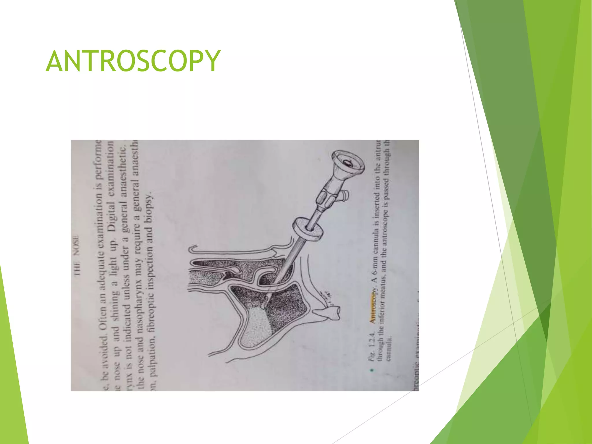 2 examination of nose and pns | PPTX