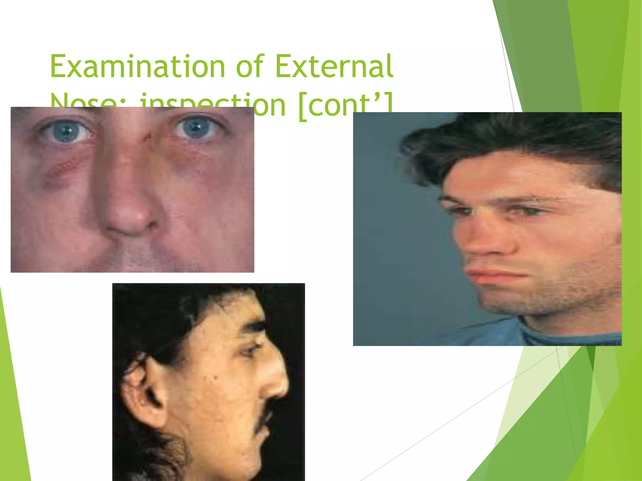 2 examination of nose and pns | PPTX