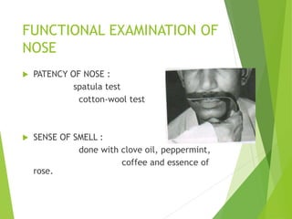 2 examination of nose and pns | PPTX