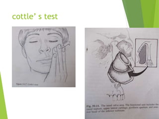 2 examination of nose and pns | PPTX