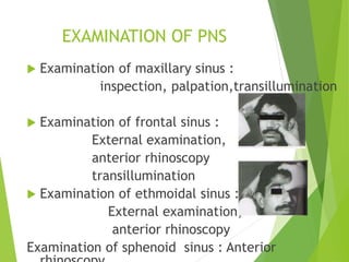 2 examination of nose and pns | PPTX