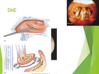2 examination of nose and pns | PPTX