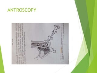 2 examination of nose and pns | PPTX