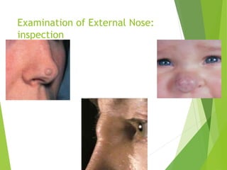 2 examination of nose and pns | PPTX