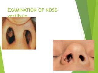 2 examination of nose and pns | PPTX