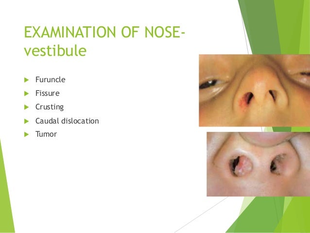 2 examination of nose and pns