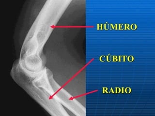 Anatomía Del Hueso Del Codo