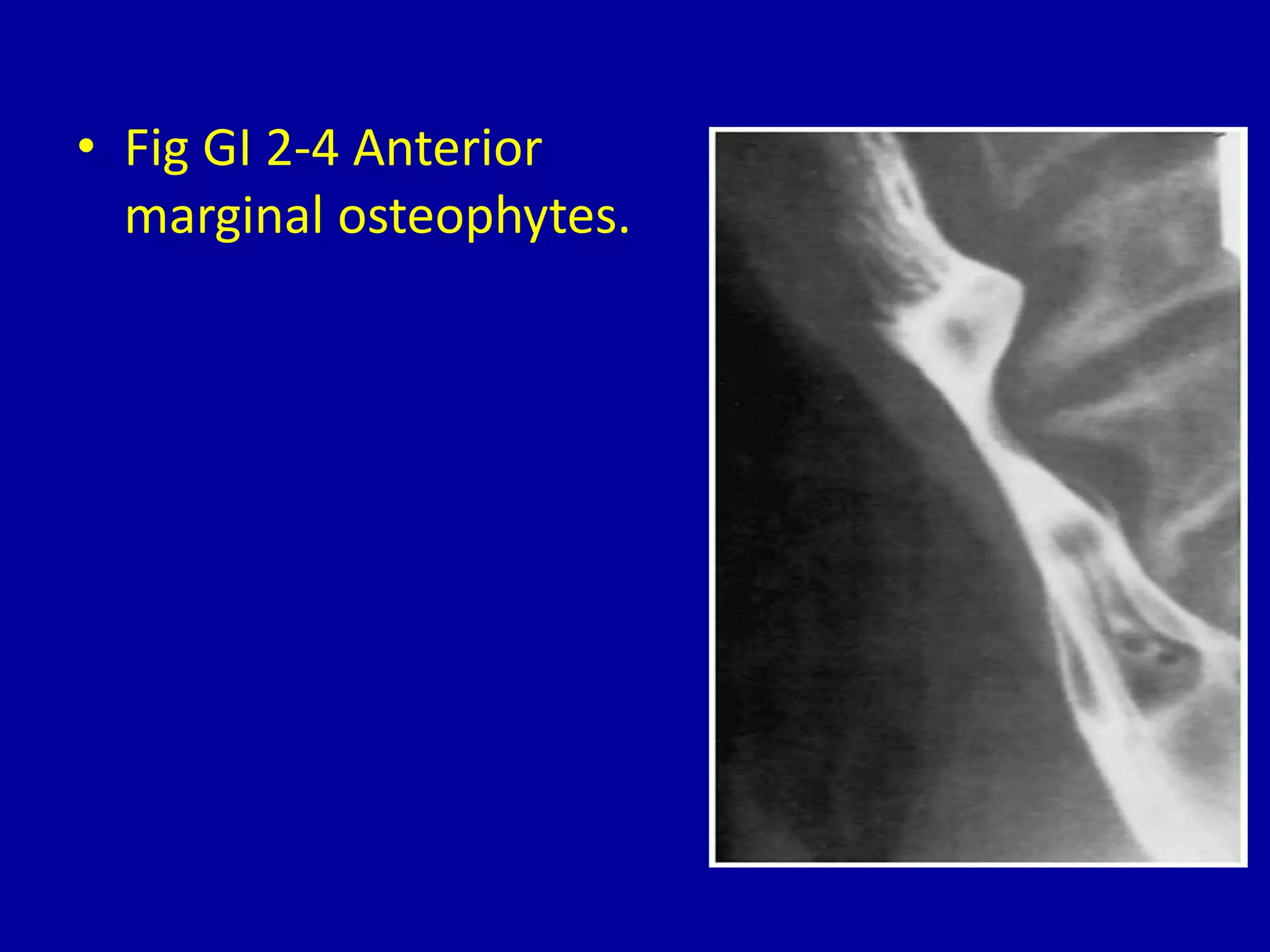 2 extrinsic impressions on the cervical esophagus | PPT